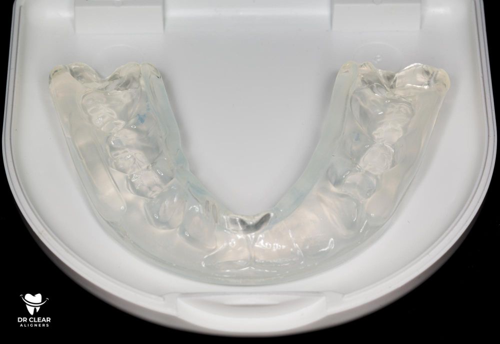 Custom Mouth Guards for Bruxism Relief | DCA Dental Clinic